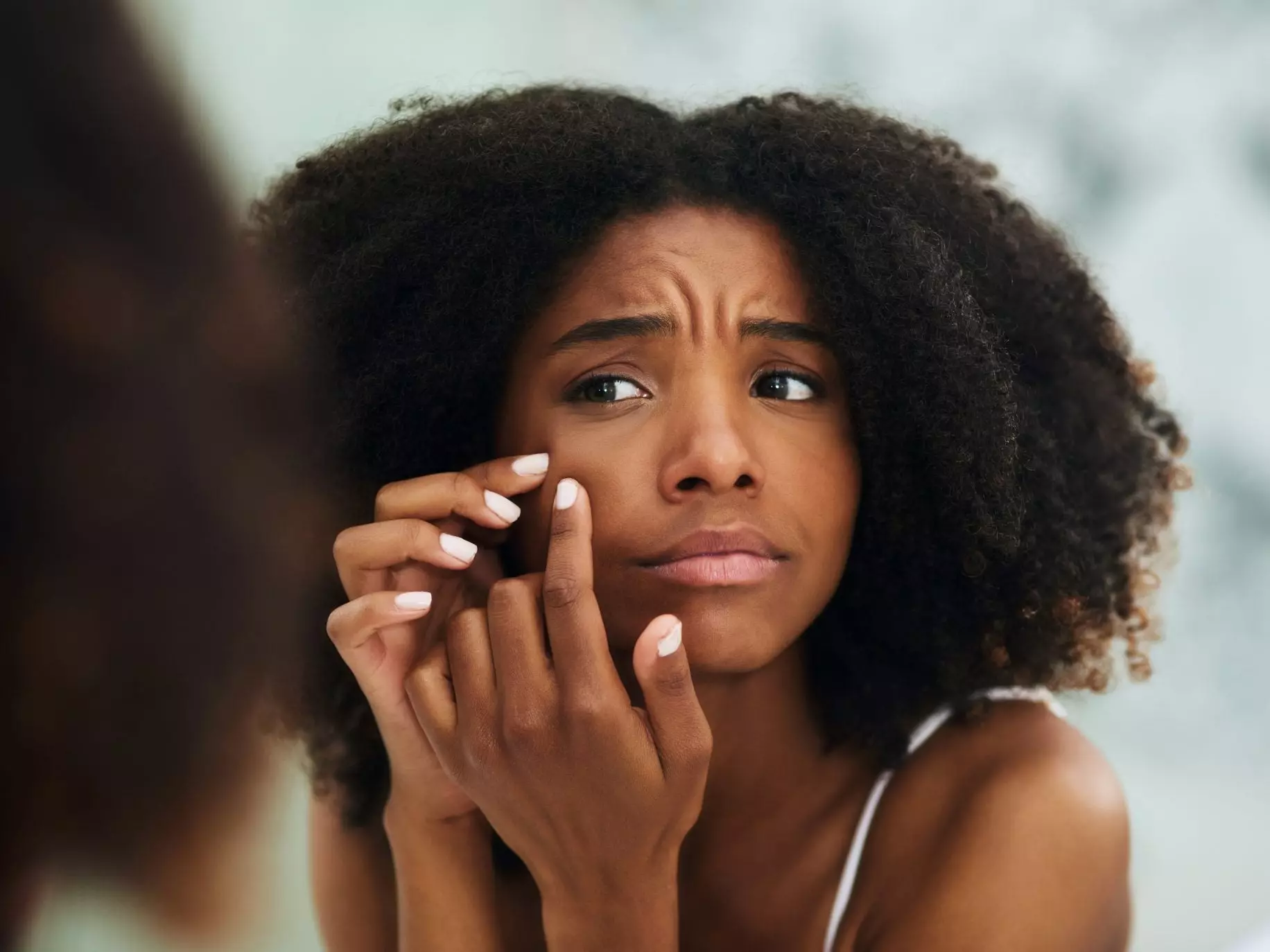 9 seruma koje vaša koža sklona aknama treba
