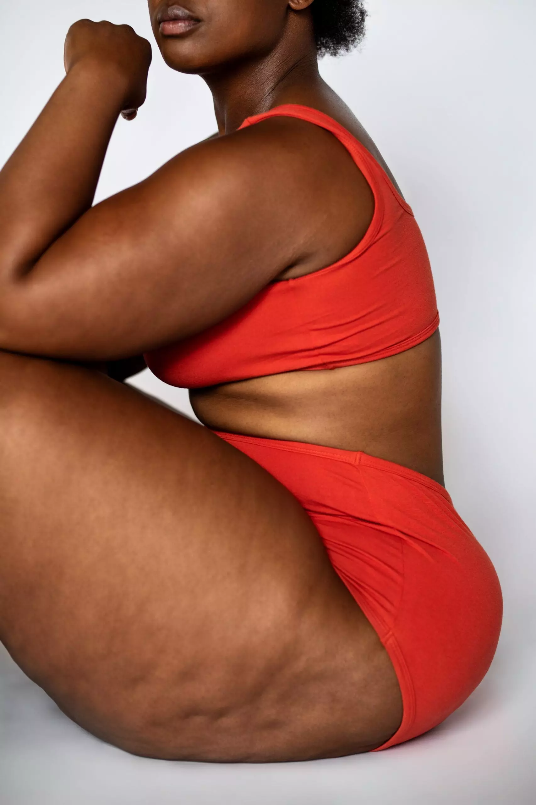 Dermatolog Michelle F. Henry Bust Myths About Cellulite